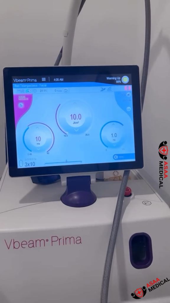 Candela Vbeam Prima Pulsed Dye Lasers System - ASAA MEDICAL